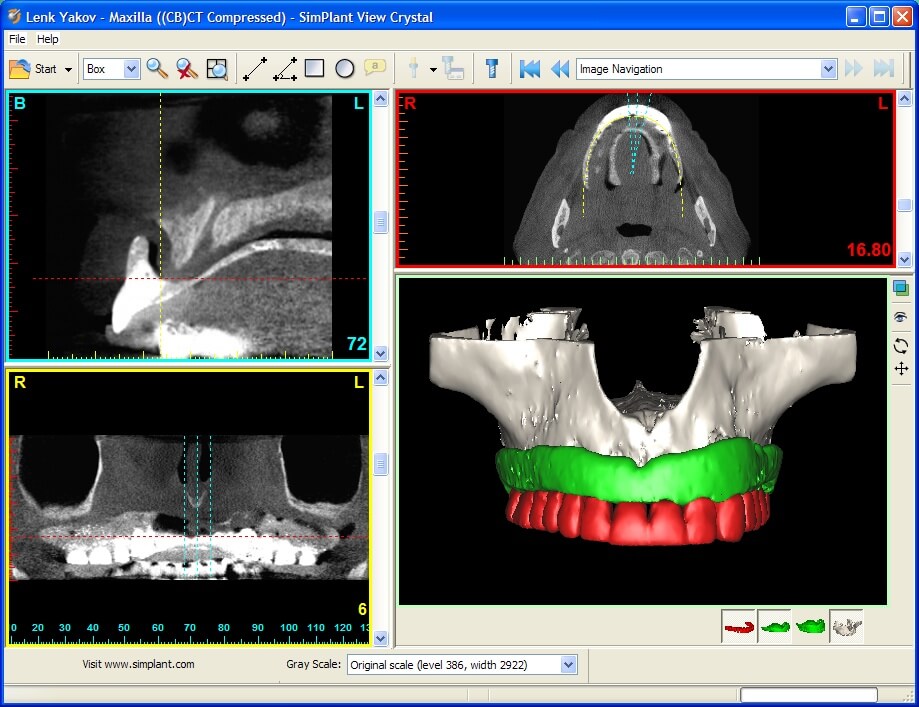 Stomatologie digitală - Green Dental - Tomografie Computerizată